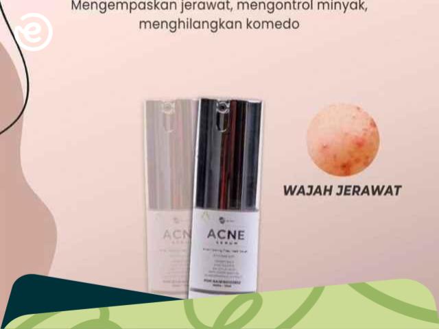 Review Serum Acne Ms Glow - Piffle.me